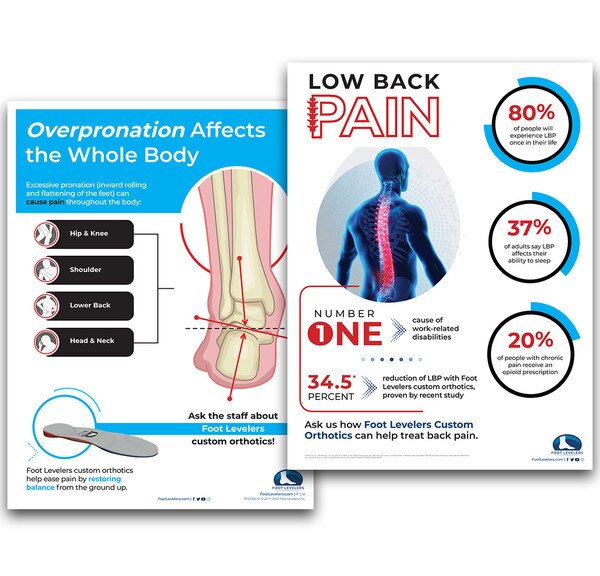 Overpronation/LBP Poster